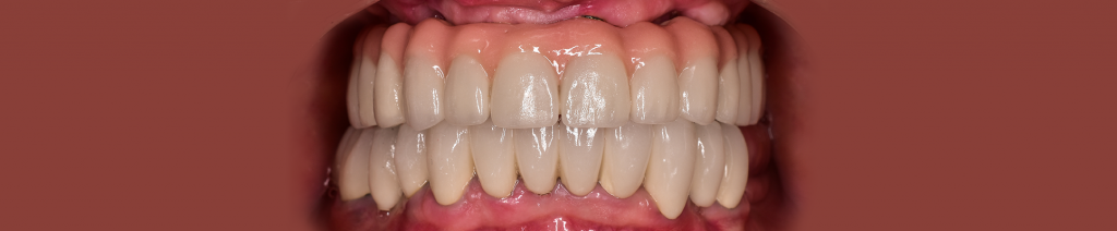 ABOUT US – Anco Dental Laboratory